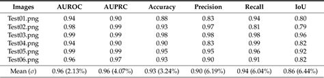 Table 2 From Automatic Coal And Gangue Segmentation Using U Net Based Fully Convolutional