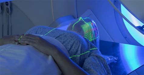 Antibacterial Regimen Reduces Severity Of Radiation Therapy Induced