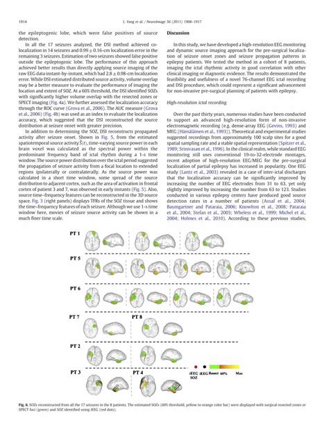 Pdf Dynamic Imaging Of Ictal Oscillations Using Non Invasive High