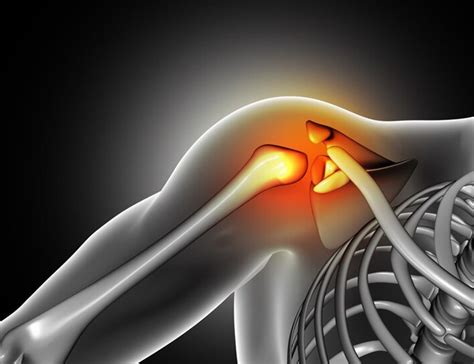 Shoulder Arthroscopy In Ludhiana Punjab Eva Hospital
