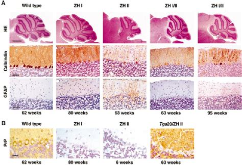 Cerebellar Cortex Histology