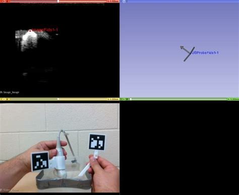 Selection Of Points During US Calibration Top Left Stylus Tip Download Scientific Diagram