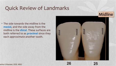 Occl 5001 Quiz 1 Mandibular Incisors Flashcards Quizlet