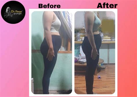 Dr Focus 150 Lb 👉 140lb 😱😱😱 14 ရက်အတွင်း 10