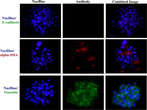 immunostaining for co culture spheroids for e cadherin vimentin and