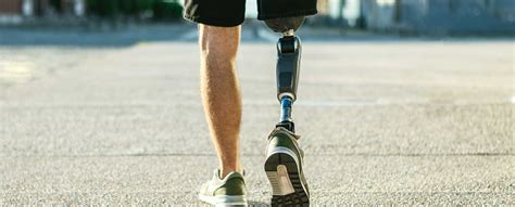 Amputation Rehabilitation Services In Rock Hill Sc Revo Rehab