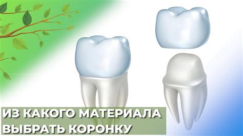 Как выбрать коронку на зуб? Виды коронок на зубы и какие коронки лучше ...