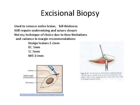 Skin Biopsy Kathleen OHanlon M D Professor Family