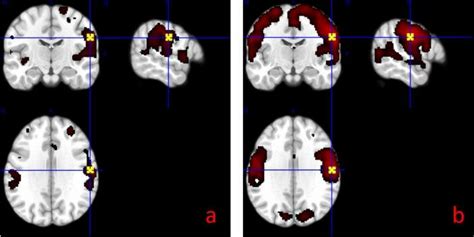 correlation maps of the brain with the selected seed marked with the