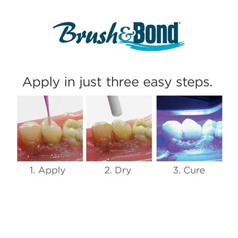 Brushandbond® Kit W Standard Activator Brushes Suredentalboutique
