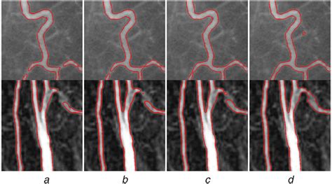 segmentation results based on download scientific diagram
