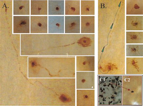 Photomicrographs Of Viral Protein Expressing Neurons Post Hs Of Download Scientific Diagram
