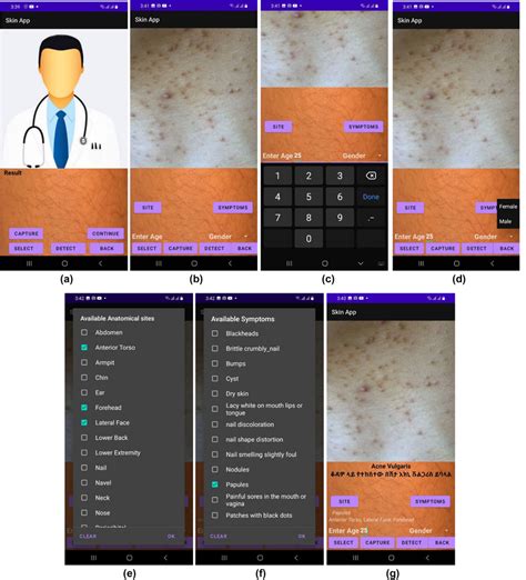 an android application used for diagnosing skin diseases using clinical