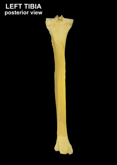 TIBIA Clinical Anatomy
