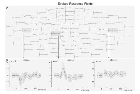 grand mean event related fields erfs a erf responses averaged