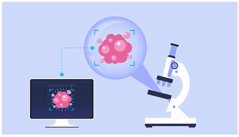 Machine Learning Meets Cancer