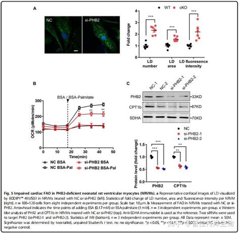 【跟着文献搞课题】之脂质代谢（脂质代谢重编程） 知乎