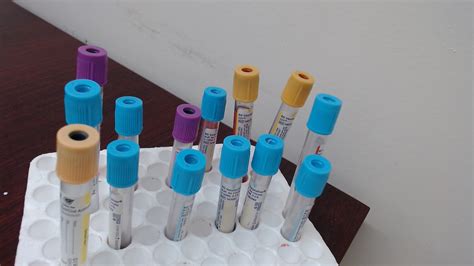 Top Label Datasets And Models Roboflow Universe