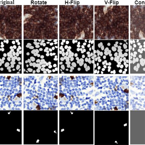 Examples From Ihc Stained Datasets 1 Lysto And 2 Nuclick Panel