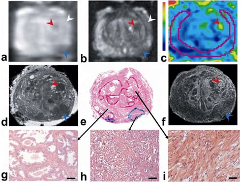 Co Registered Images Illustrate The Tissue Microstructure Underpinning
