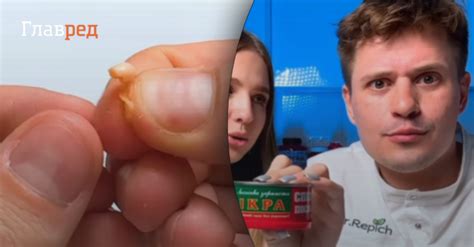 Как отличить натуральную икру от подделки за 5 минут Главред
