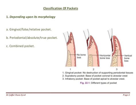 023periodontal Pocket
