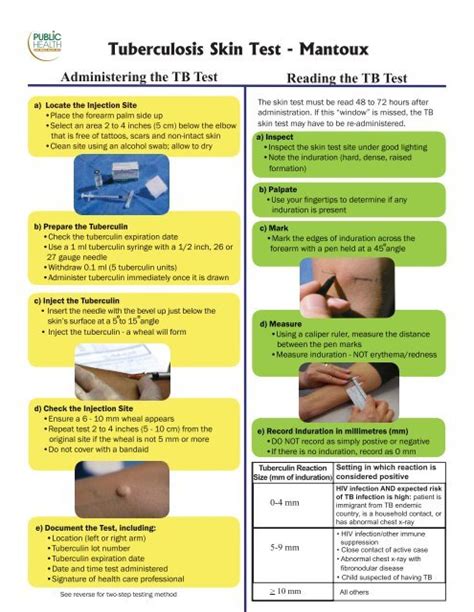 Tuberculosis Testing And Reading TB Results Grey Bruce Health