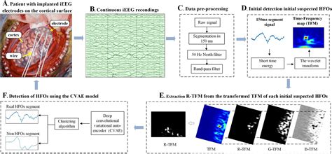 Frontiers Unsupervised Detection Of High Frequency Oscillations In Intracranial