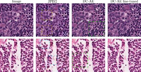 pathology image compression with pre trained autoencoders generative