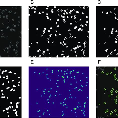 workflow of cell segmentation a original phase contrast microscopy