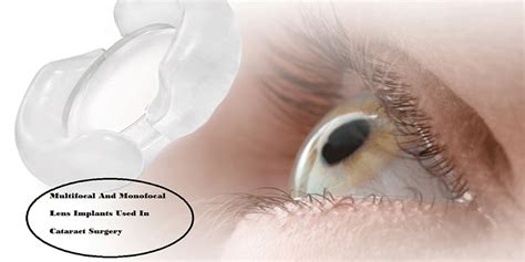 A Comparison Of Multifocal And Monofocal Lens Implants Used In Catarac