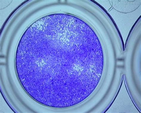 Machine Learning Based Automated Quantification Machine For Virus Plaque Assay Counting Peerj