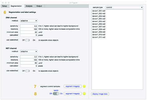 Segmentation Tab For Netquant The Segmentation Parameters Used Download Scientific Diagram