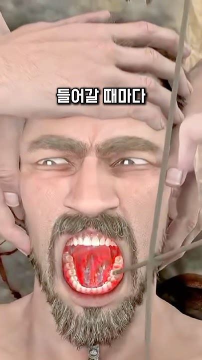 마취없이 치아에 구멍을 뚫는다고 고대 치과의 충격적인 치료법 Youtube