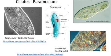 Paramecium 400x Labeled