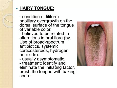 Keratosis And Related Disorder Of The Oral Mucosa Pptx