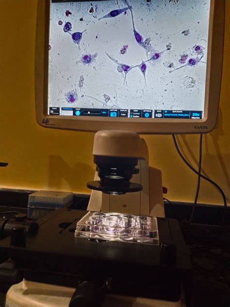 Ostini Erna Posted On Linkedin