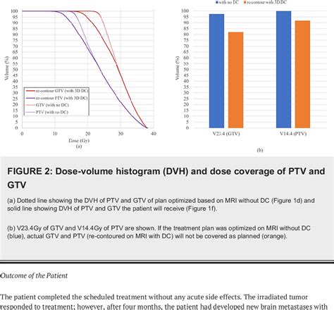 Figure 2 From The Impact Of System Related Magnetic Resonance Imaging
