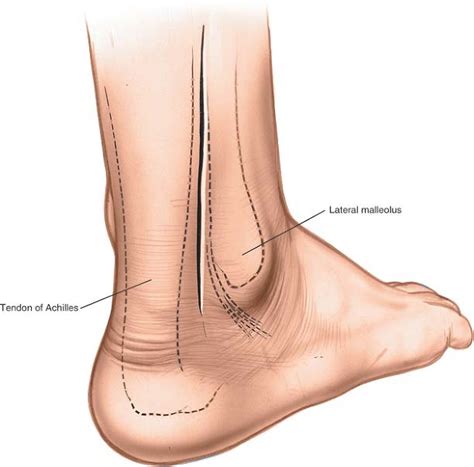 The Ankle And Foot Musculoskeletal Key