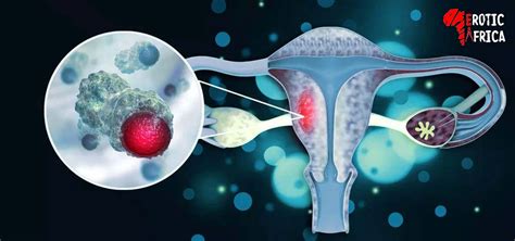 Cervical Cancer Awareness Month Ways To Protect Yourself From Cervical Cancer Erotic Africa