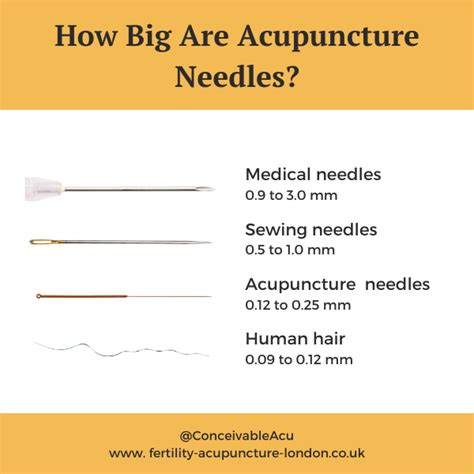 London Acupuncture Clinic Acupuncturist With 20 Yrs Experience