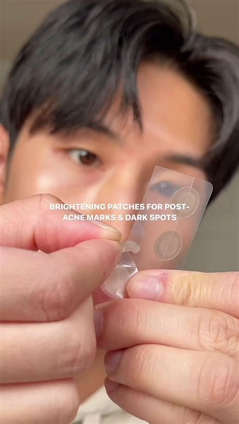 Just Use A Pimple Patch Skin Care Acne Pimples