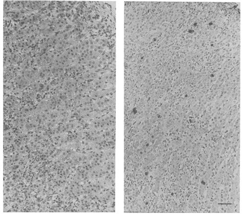 In Situ Hybridization Using Biotin Labelled Fige Purified Cmv Dna On