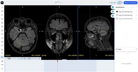 Annotate Dicom And Nifti Files