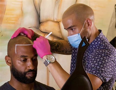 What Tools Are Used In Scalp Micropigmentation Scalp Micro Usa