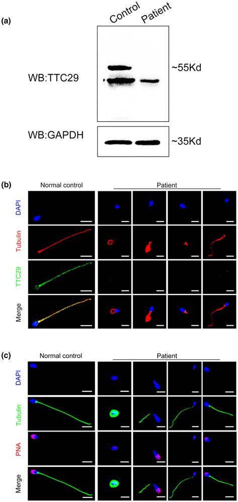 The Impact Of Biallelic Mutations In Ttc29 On Its Expression A The Download Scientific