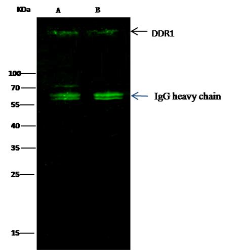 Ddr1 Antibodies Anti Ddr1 Sino Biological
