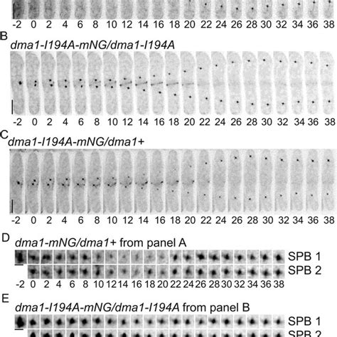 Dynamics Of Dma1 Localization Through The Cell Cycle A And D Live Dynamics Of Dma1 Localization Through The Cell Cycle A And D Live