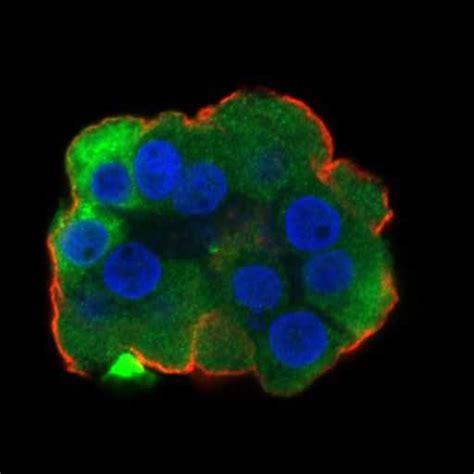 Single Cell Isolation Of Human Lung Organoids