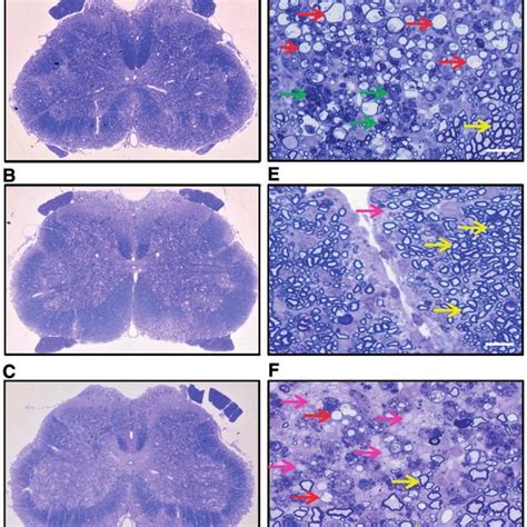 Photomicrographs Of High Resolution Representative Transverse Sections Download Scientific